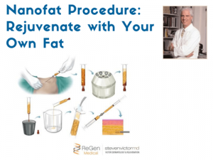 Nanofat Procedure: Rejuvenate with Your Own Fat